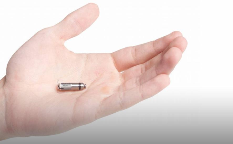 Installato a Bari micro pacemaker wireless per incontinenza - La ...